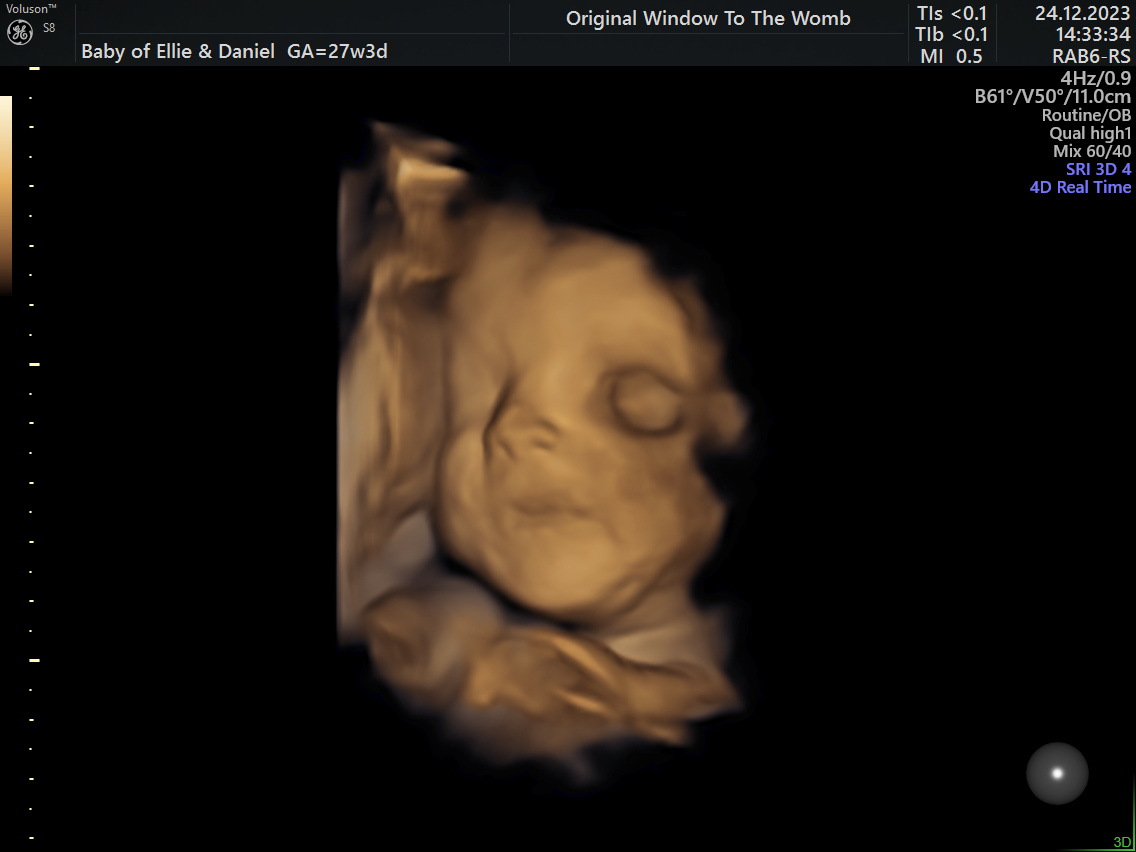 Gallery | Gallery 27 Weeks - Original Window to the Womb